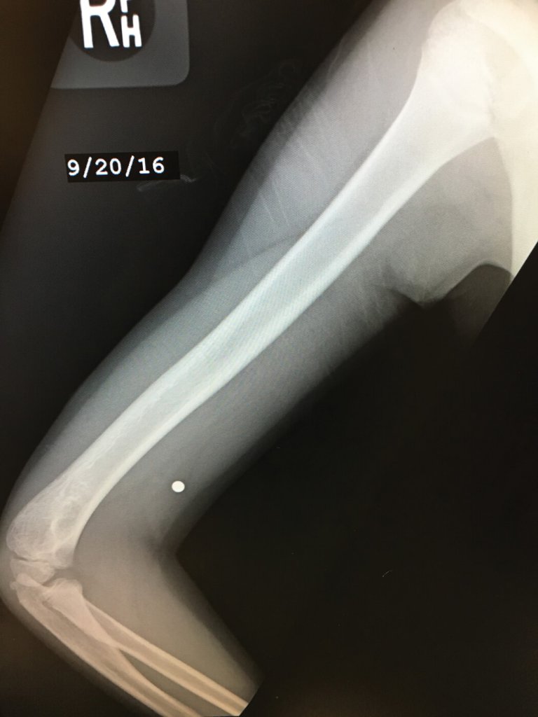 First Aid in the Field: Gunshots and Other Wounds